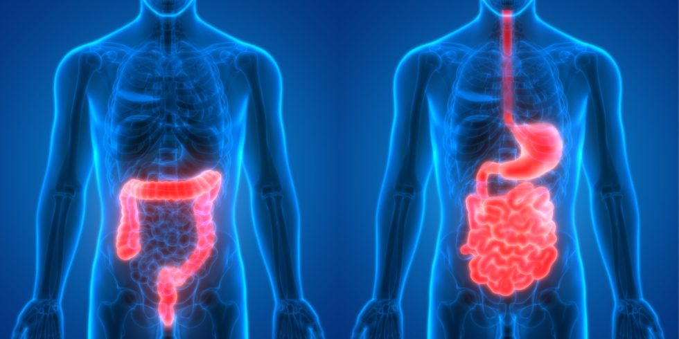 Colonoscopy Preperation Sydney - Dr Ewan MacDermid